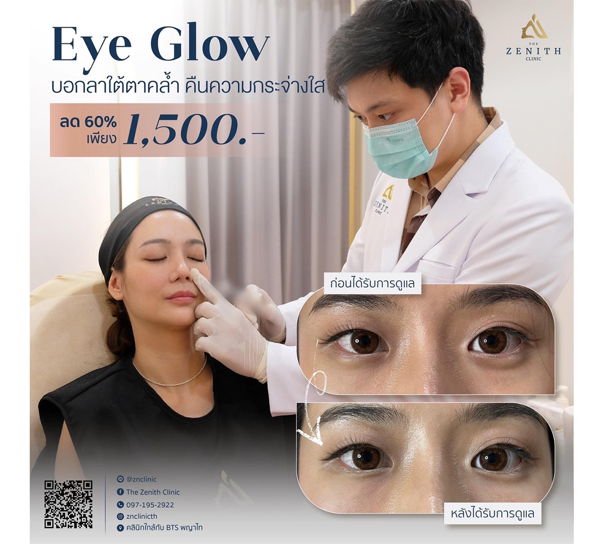 EYE GLOW - THE ZENITH CLINIC